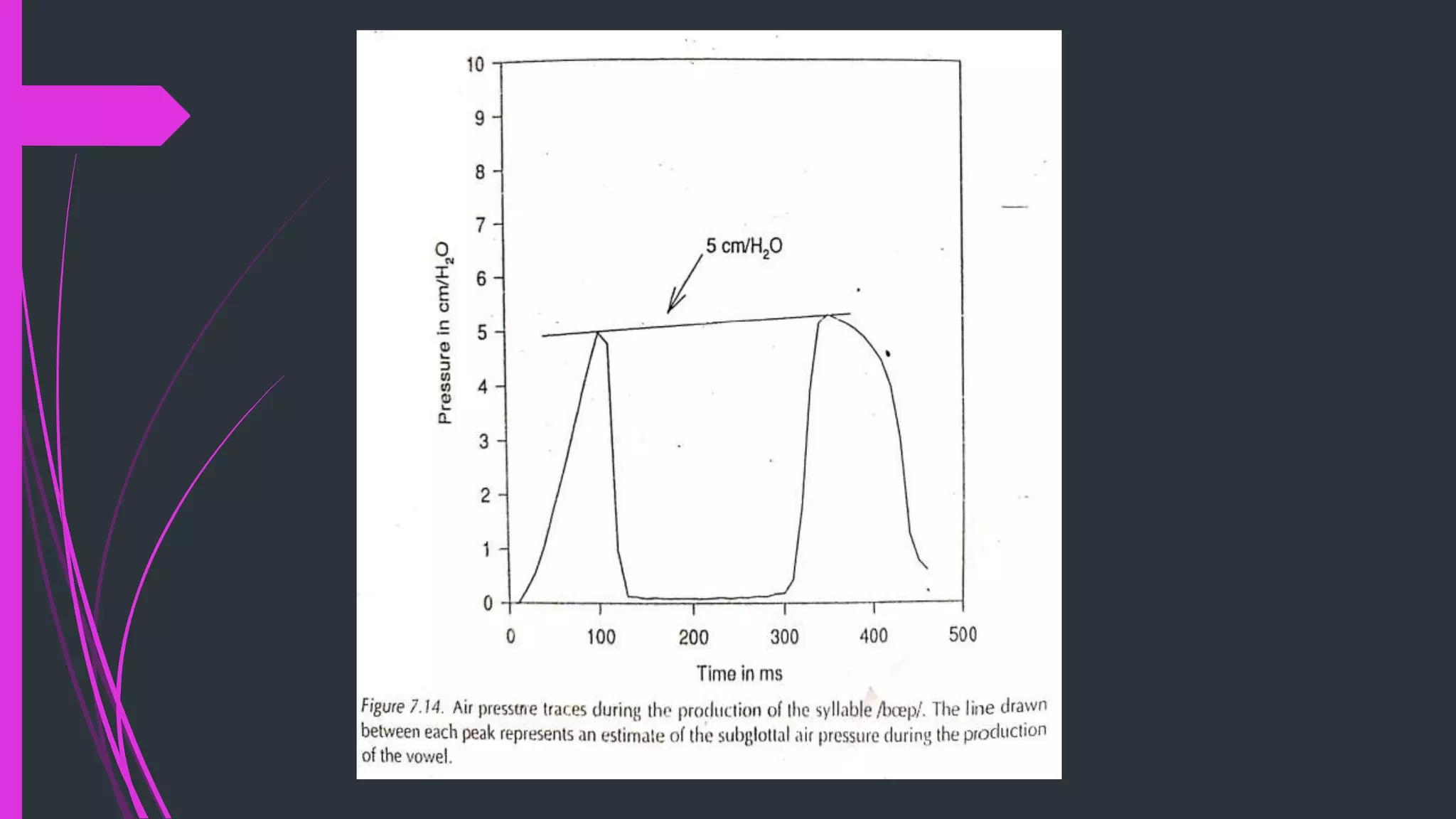 Electroglottography & Inverse Filtering Procedures | PPTX