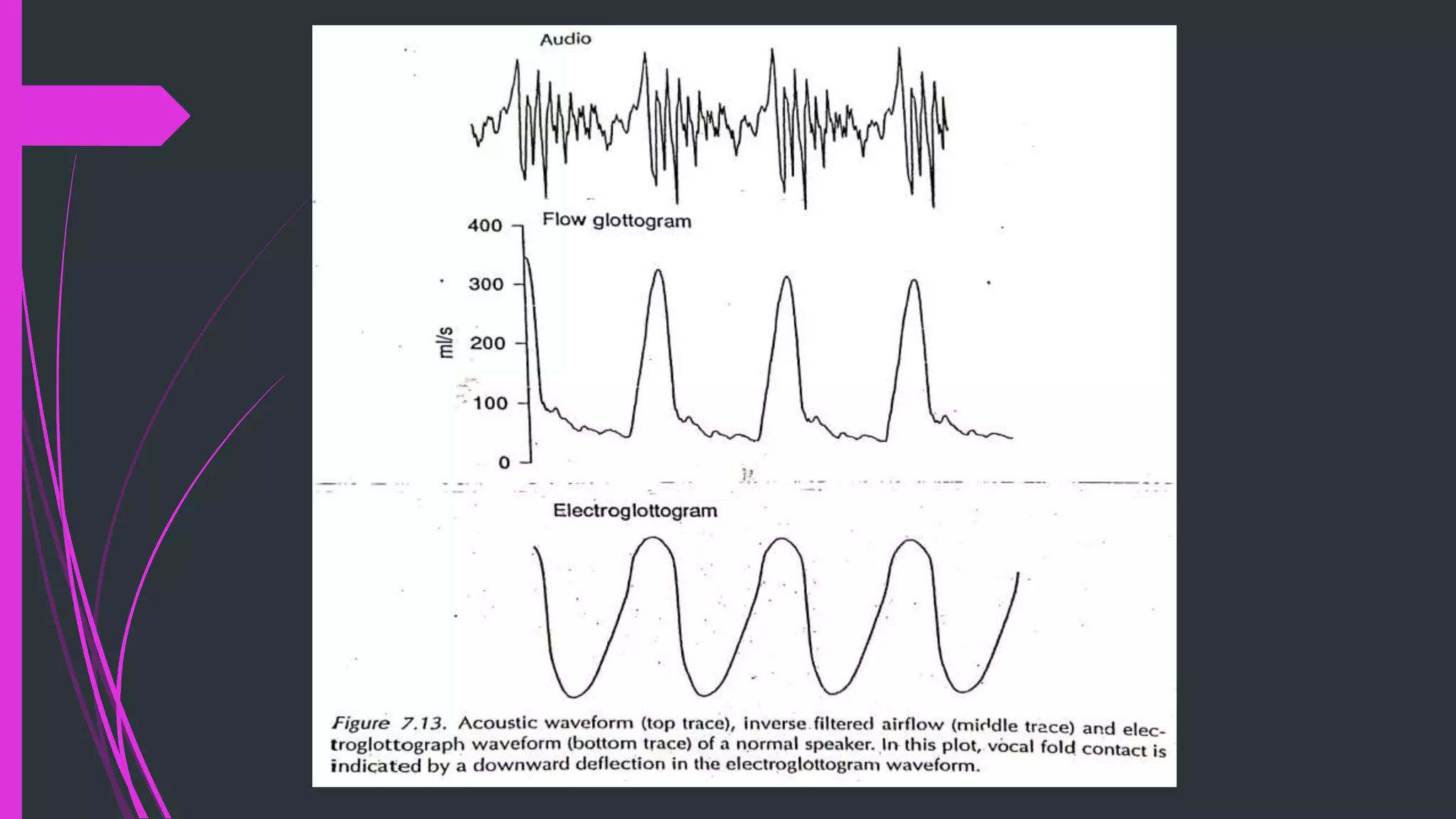 Electroglottography & Inverse Filtering Procedures | PPTX