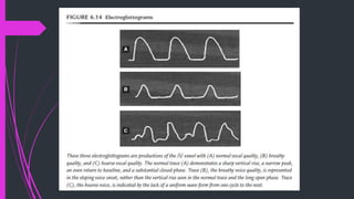 Electroglottography & Inverse Filtering Procedures | PPTX