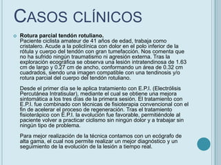 Electrolisis percutánea intratisular (epi) | PPTX
