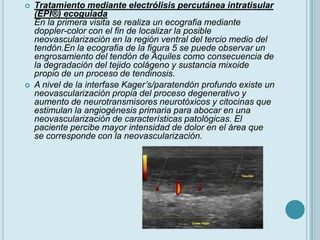 Electrolisis percutánea intratisular (epi) | PPTX