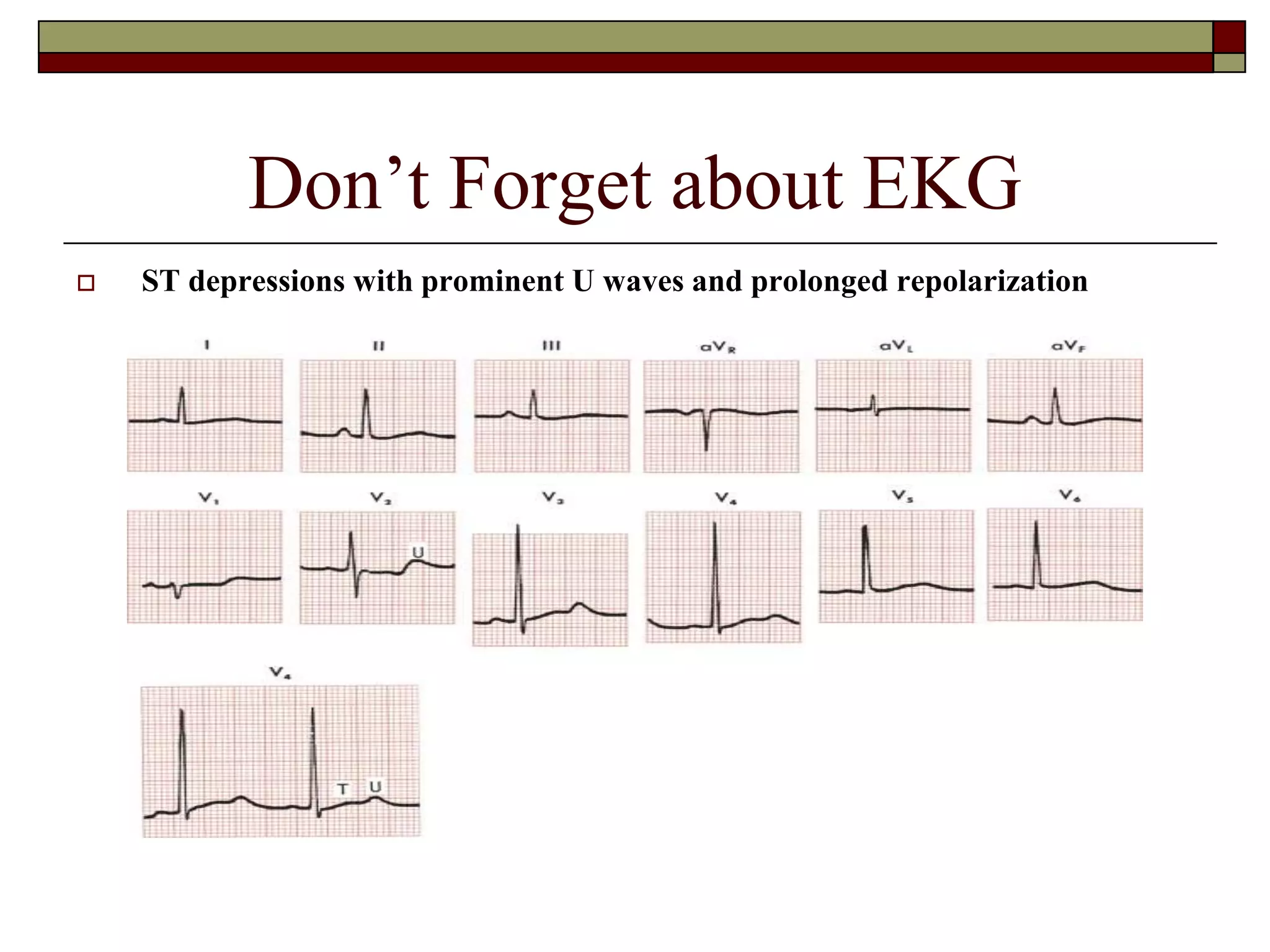 Electrolyte Imbalance and EKG Changes | PPT