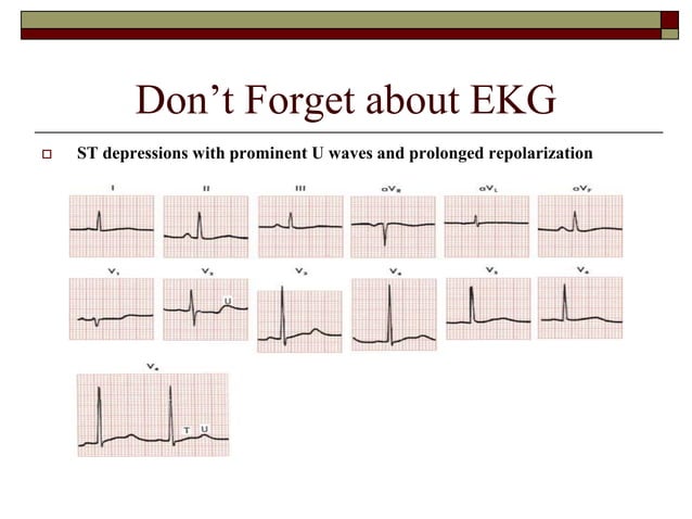 Electrolyte Imbalance and EKG Changes | PPT