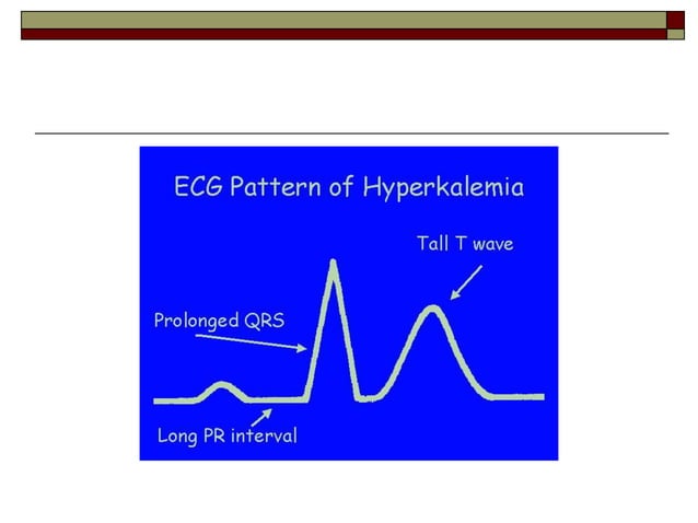 Electrolyte Imbalance and EKG Changes | PPT