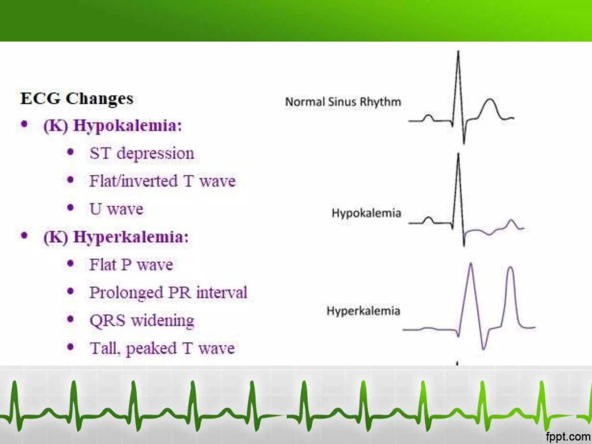 Electrolyte and metabolic ECG abnormalities | PPTX