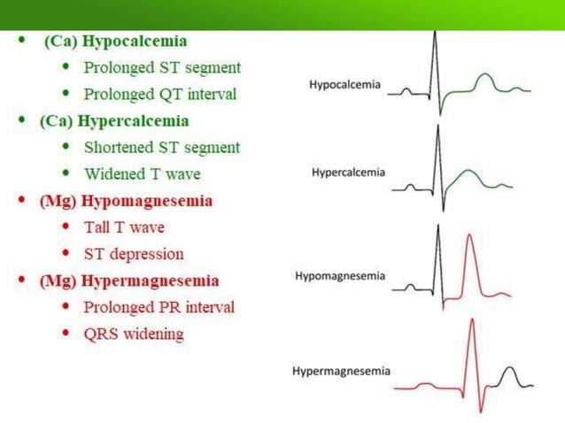 Electrolyte and metabolic ECG abnormalities | PPTX