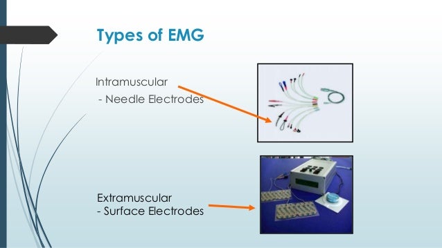 Electromyogram