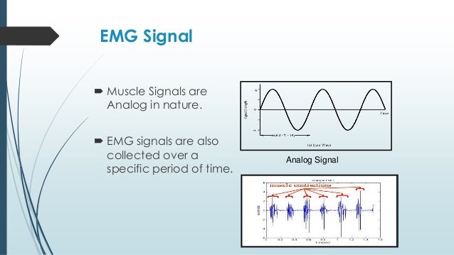 Electromyogram