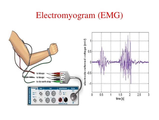 Electromyograph(EMG)