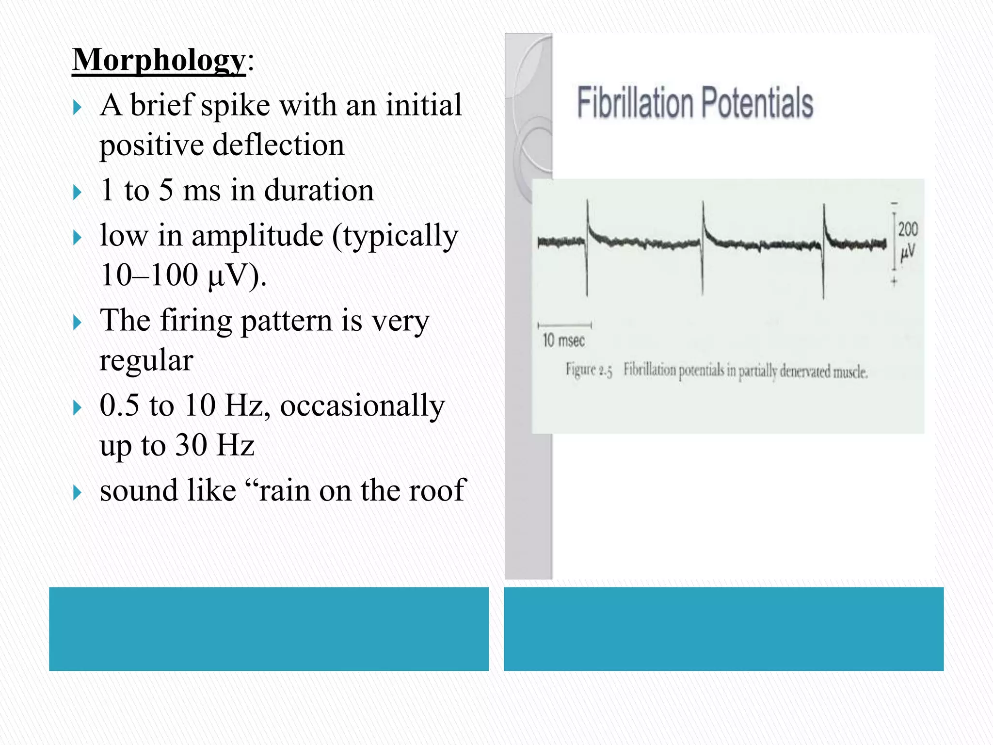 Electromyography (EMG) Basics | PPTX