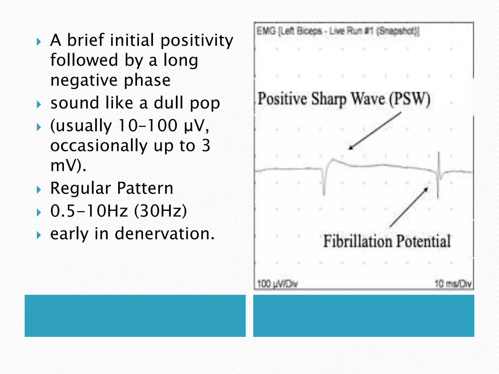 Electromyography (EMG) Basics | PPTX