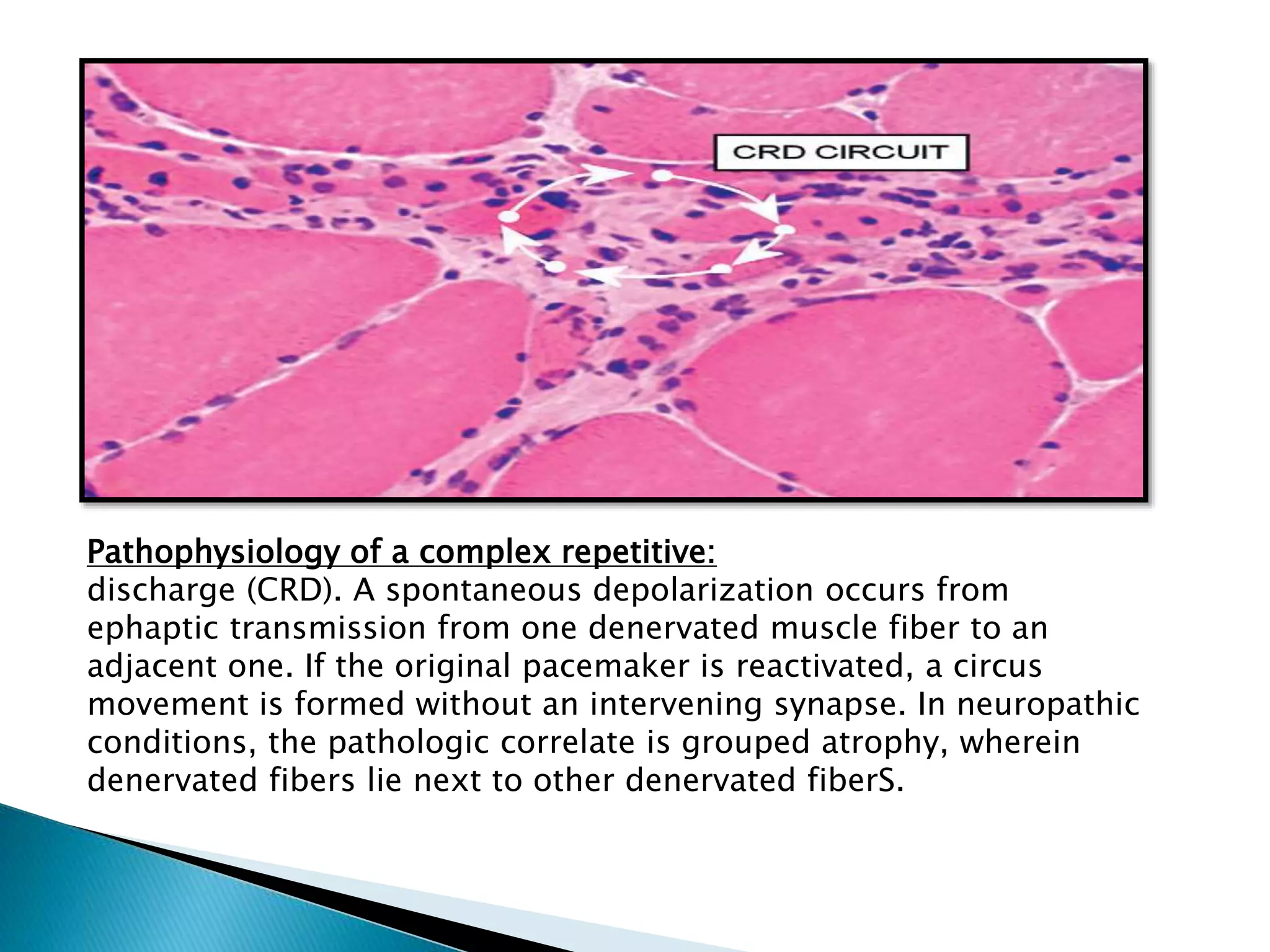 Electromyography (EMG) Basics | PPTX