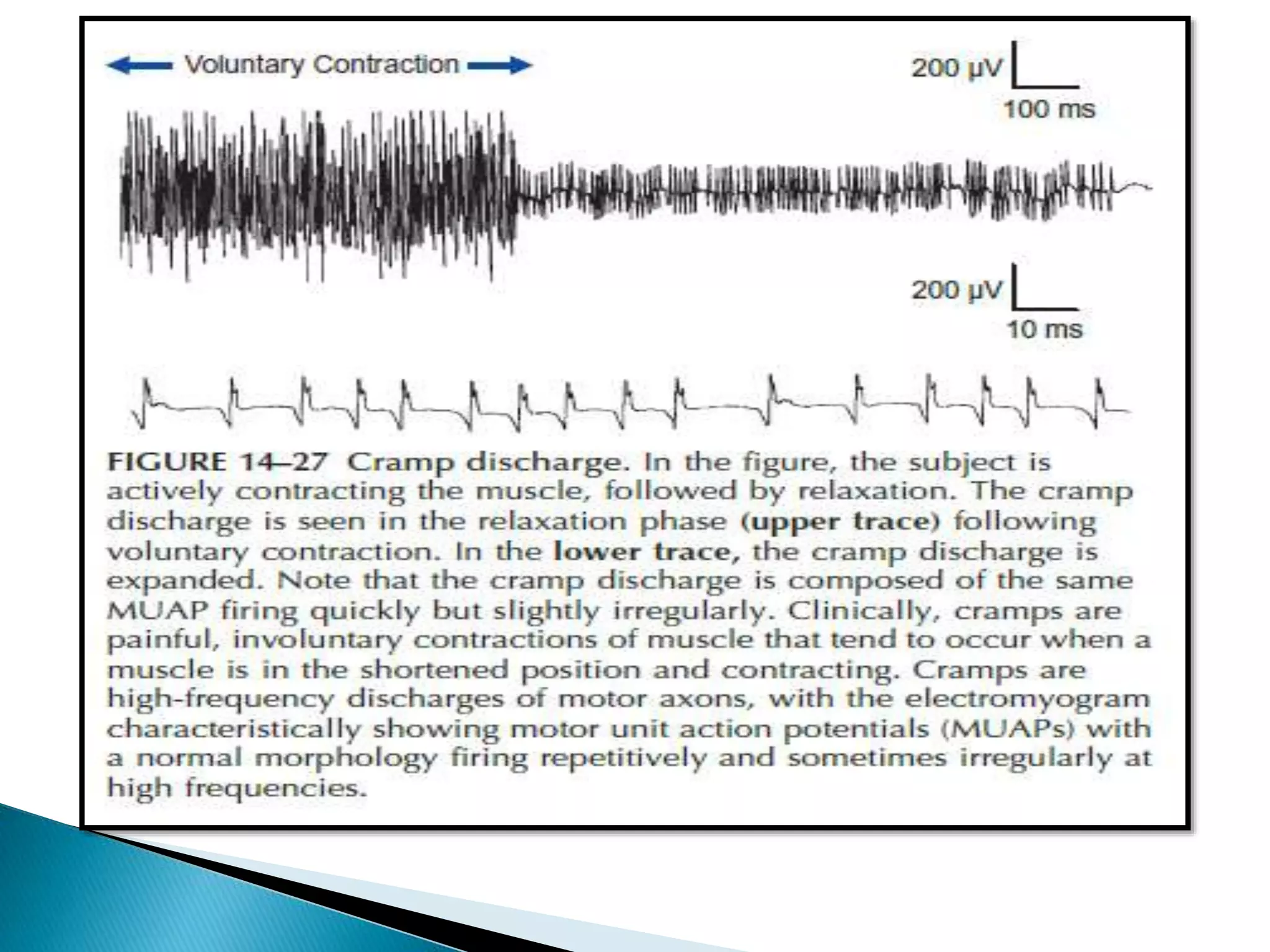 Electromyography (EMG) Basics | PPTX