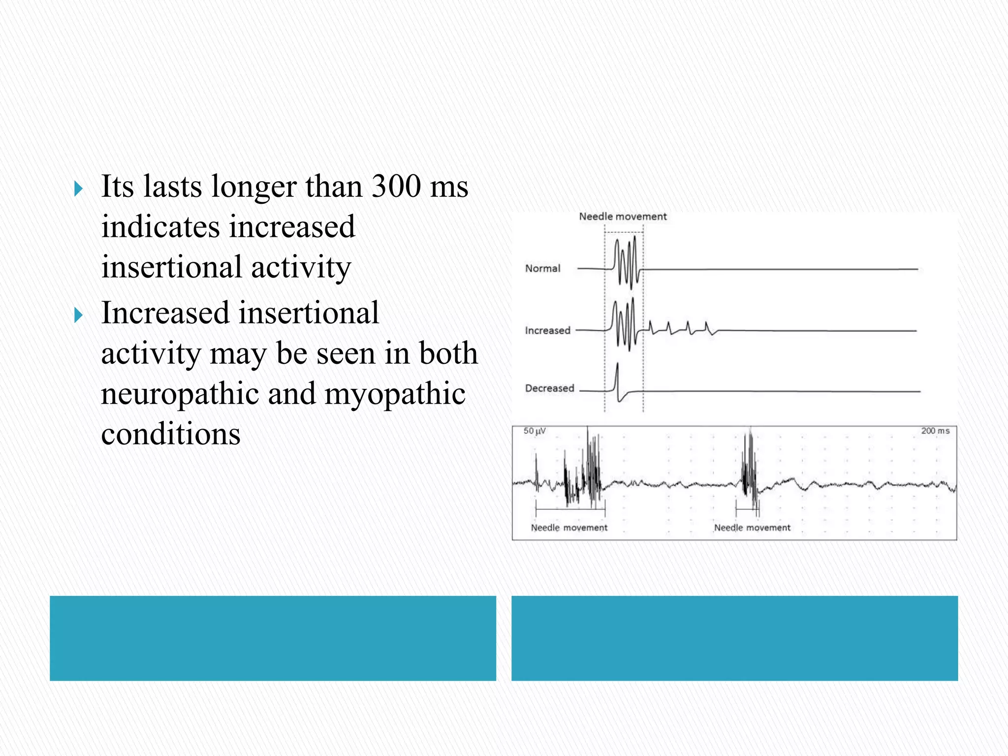Electromyography (EMG) Basics | PPTX