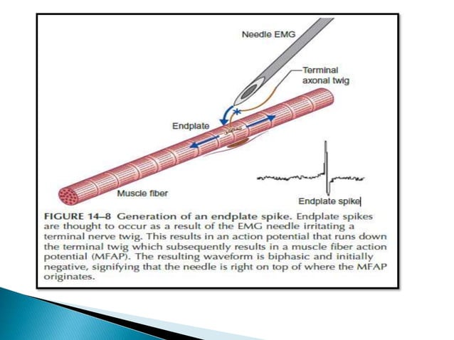 Electromyography (EMG) Basics | PPTX