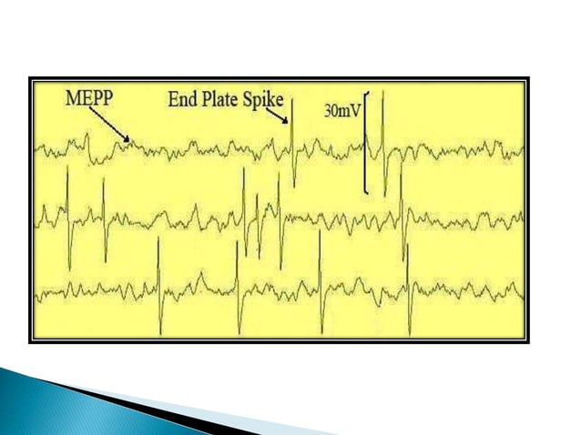 Electromyography (EMG) Basics | PPTX