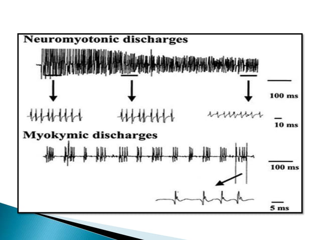 Electromyography (EMG) Basics | PPTX
