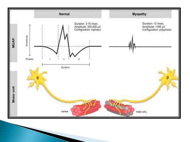 Electromyography (EMG) Basics | PPTX