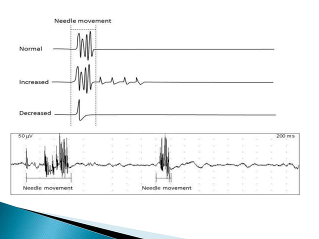 Electromyography (EMG) Basics | PPTX