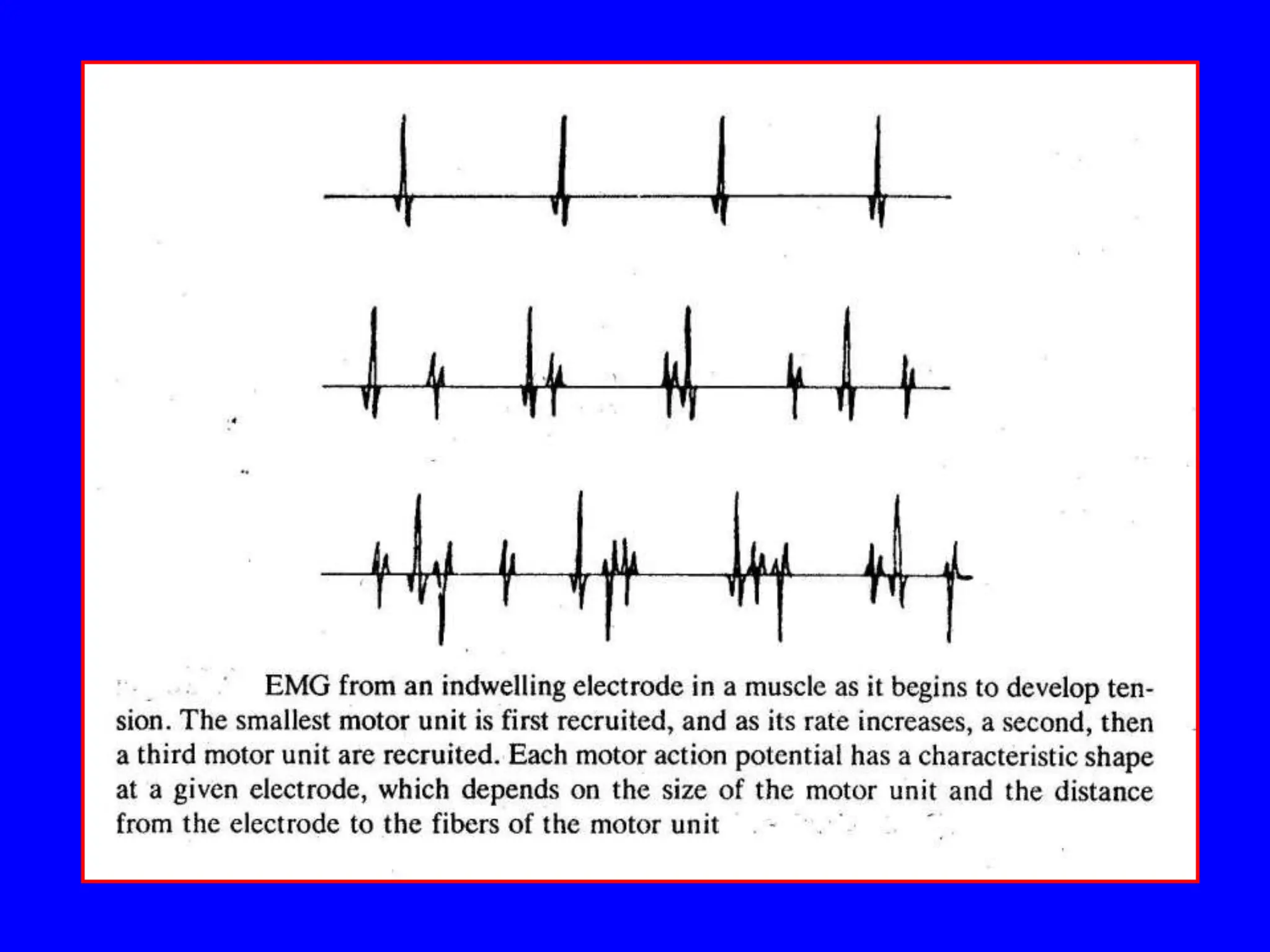 Electromyography and its uses about signals.ppt