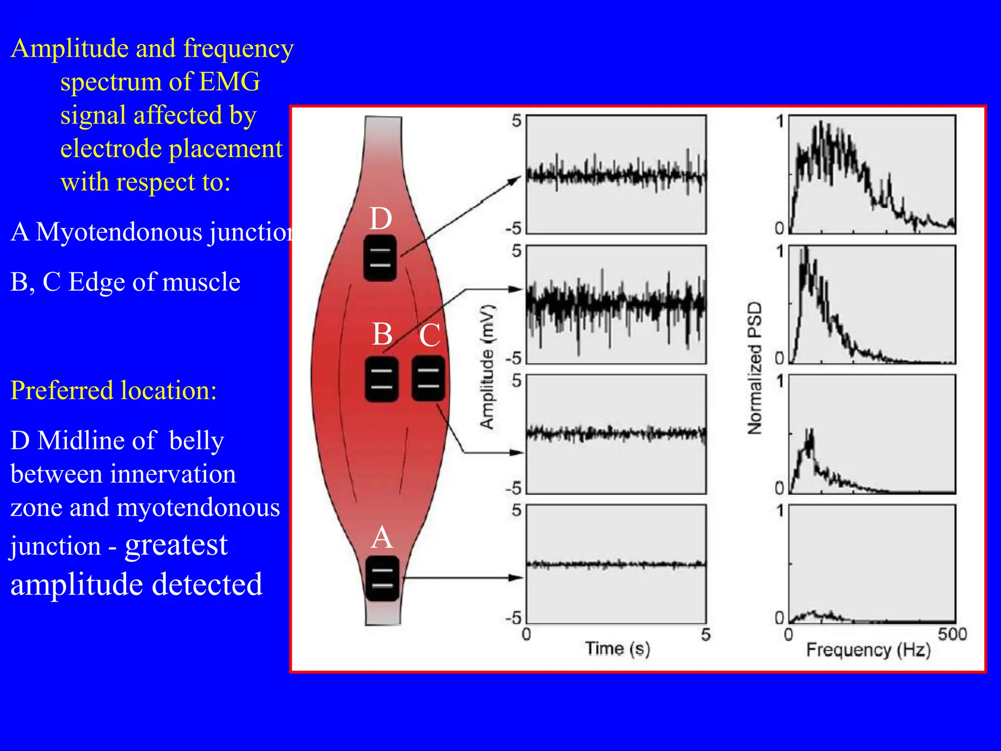 Electromyography and its uses about signals.ppt