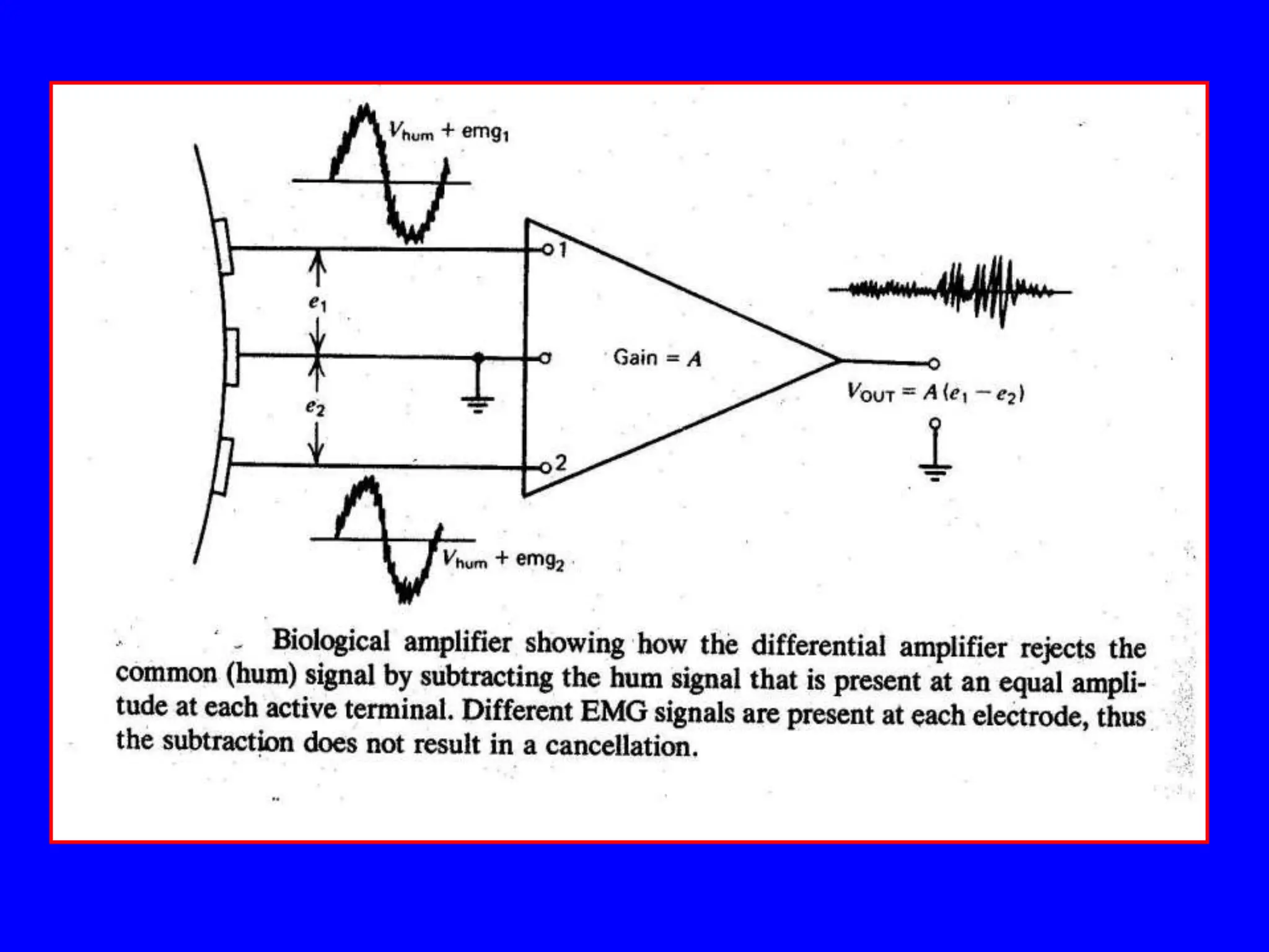 Electromyography and its uses about signals.ppt