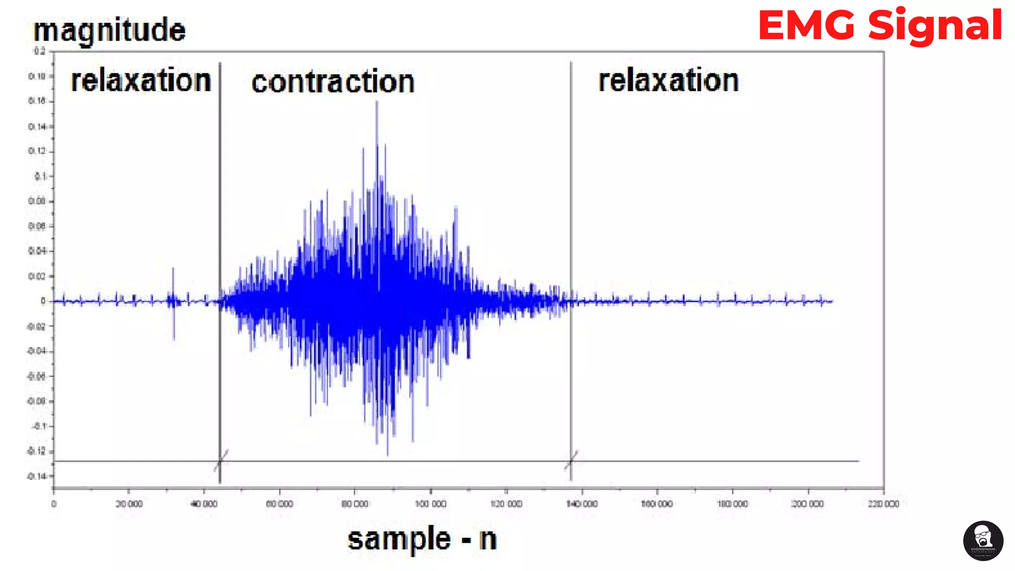 Electromyography (emg) basics | PDF | Medical Tests | Medical Health