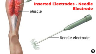 Electromyography (emg) basics | PDF | Medical Tests | Medical Health