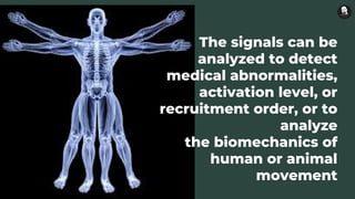 Electromyography (emg) basics | PDF | Medical Tests | Medical Health