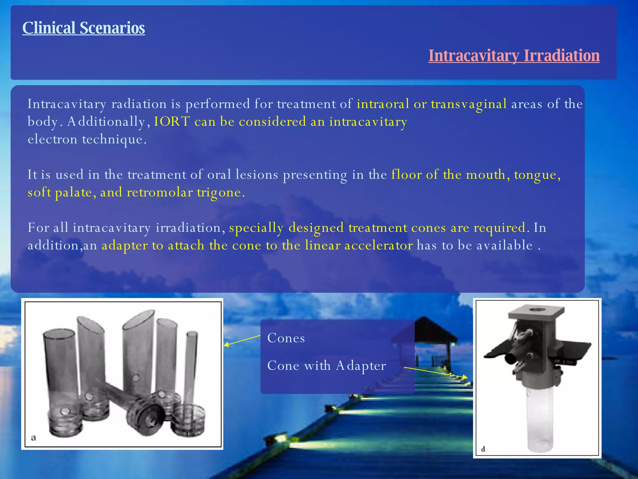 Electron Beam Therapy | PPT