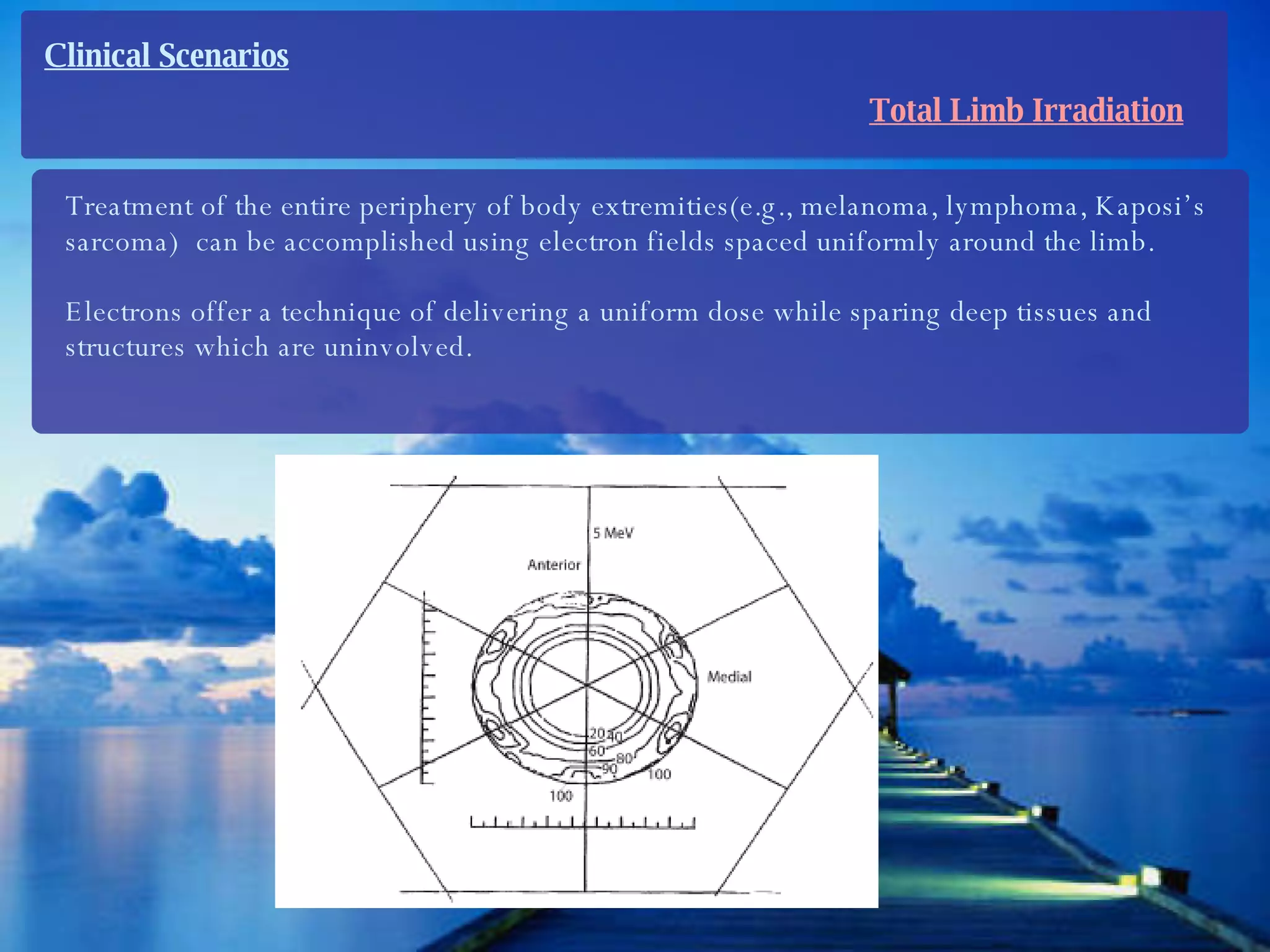 Electron Beam Therapy | PPT