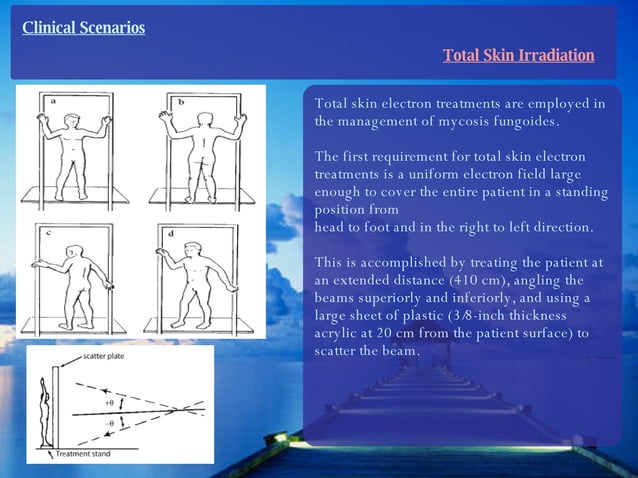 Electron Beam Therapy | PPT
