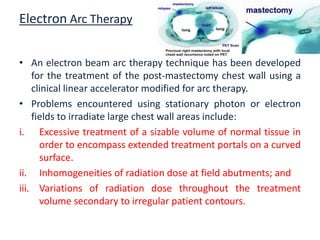 Electron arc therapy | PPTX