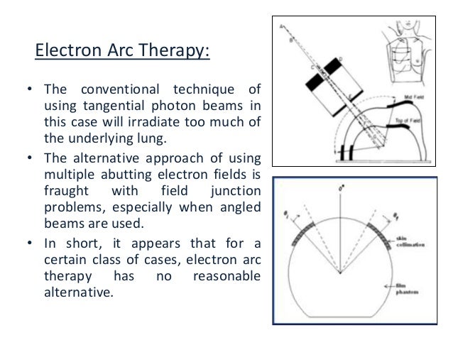 Electron arc therapy