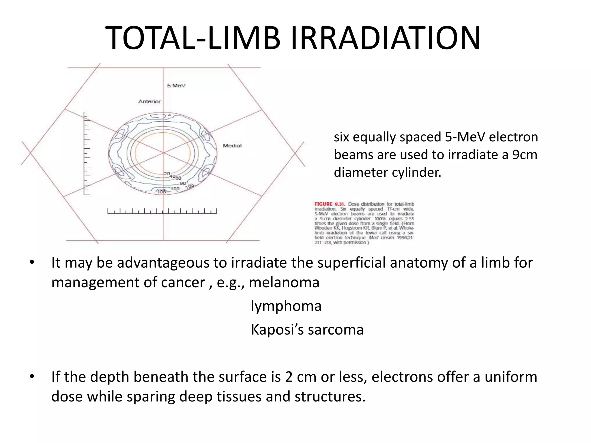 Electron beam therapy | PPTX