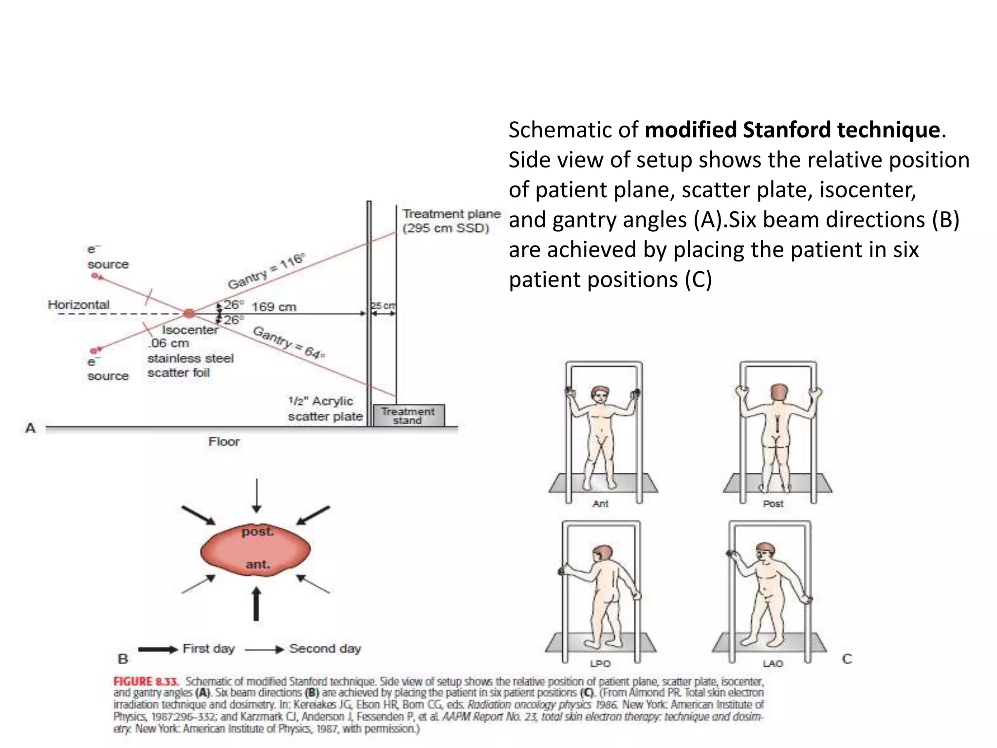 Electron beam therapy | PPTX