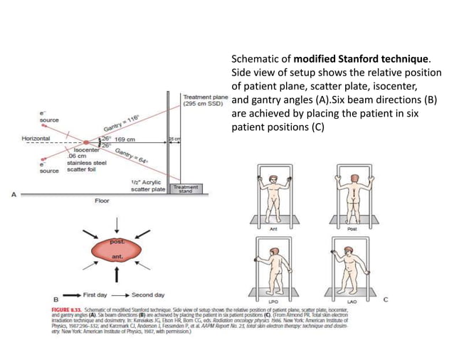 Electron beam therapy | PPTX