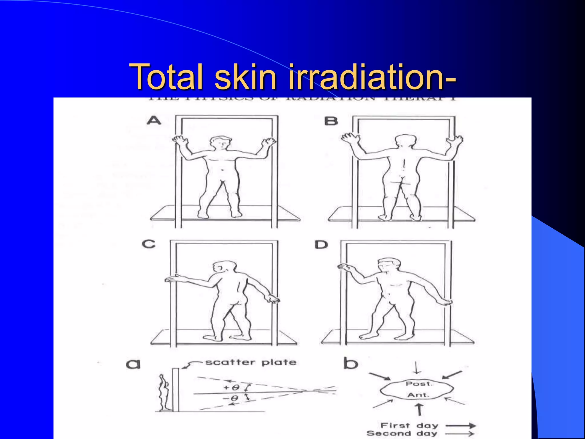 ELECTRON BEAM RADIOTHERAPY | PPT