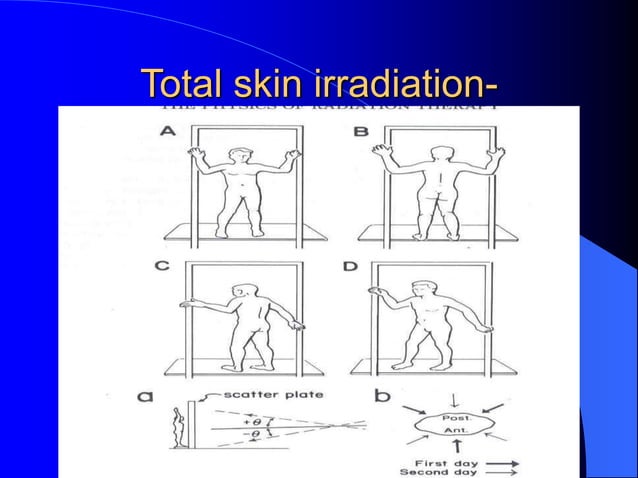 ELECTRON BEAM RADIOTHERAPY | PPT | Skin and Dermatology | Diseases and ...