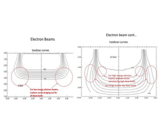Electron Beam Therapy | PDF