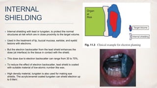 ELECTRON BEAM THERAPY radio therapy PART 2 copy.pptx