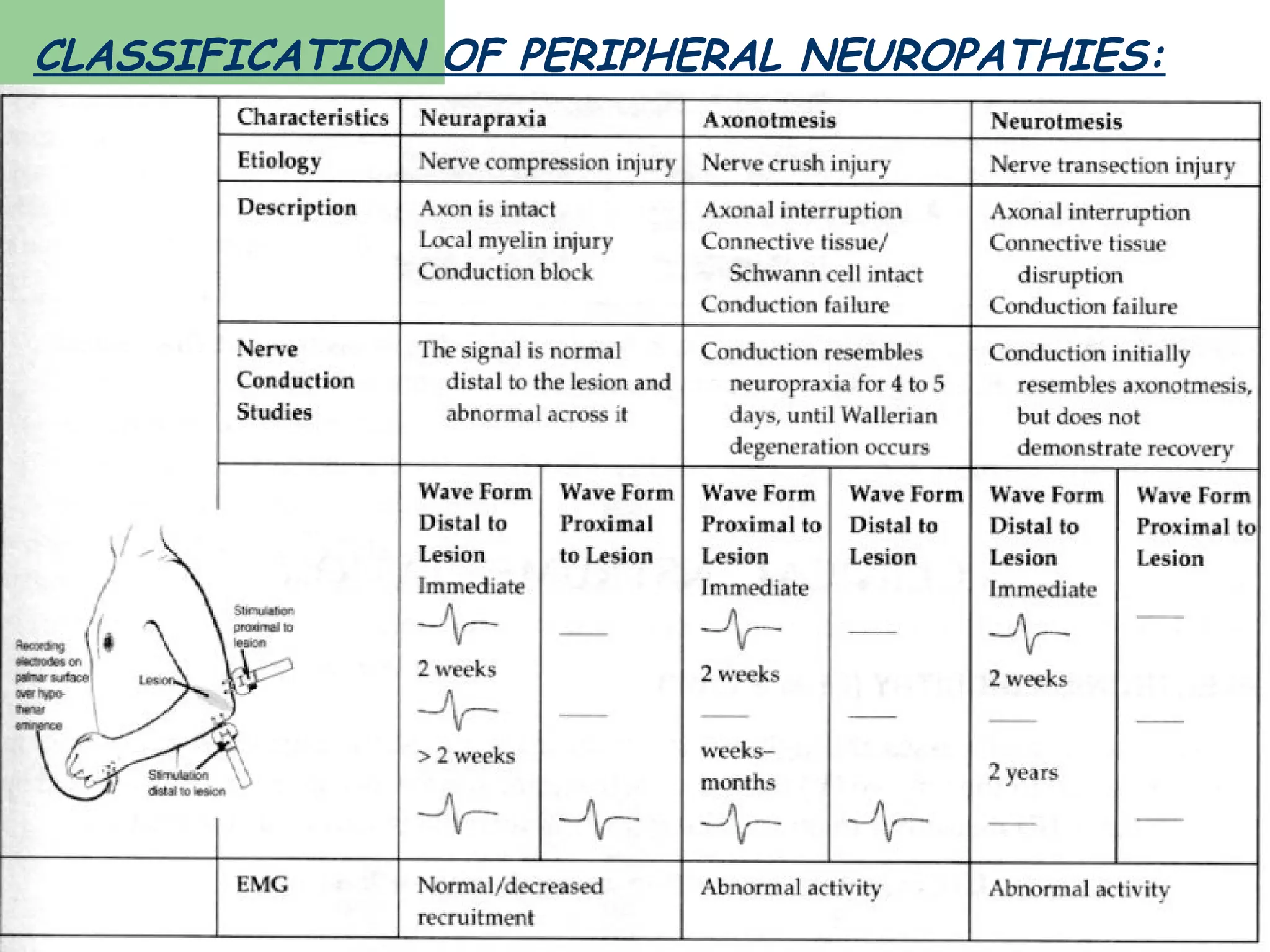 Electroneurography | PPT