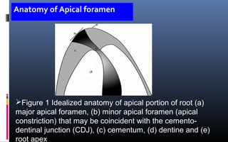 Electronic apex locator by dr.imran m.shaikh | PPT