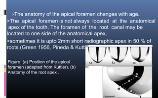 Electronic apex locator by dr.imran m.shaikh | PPT