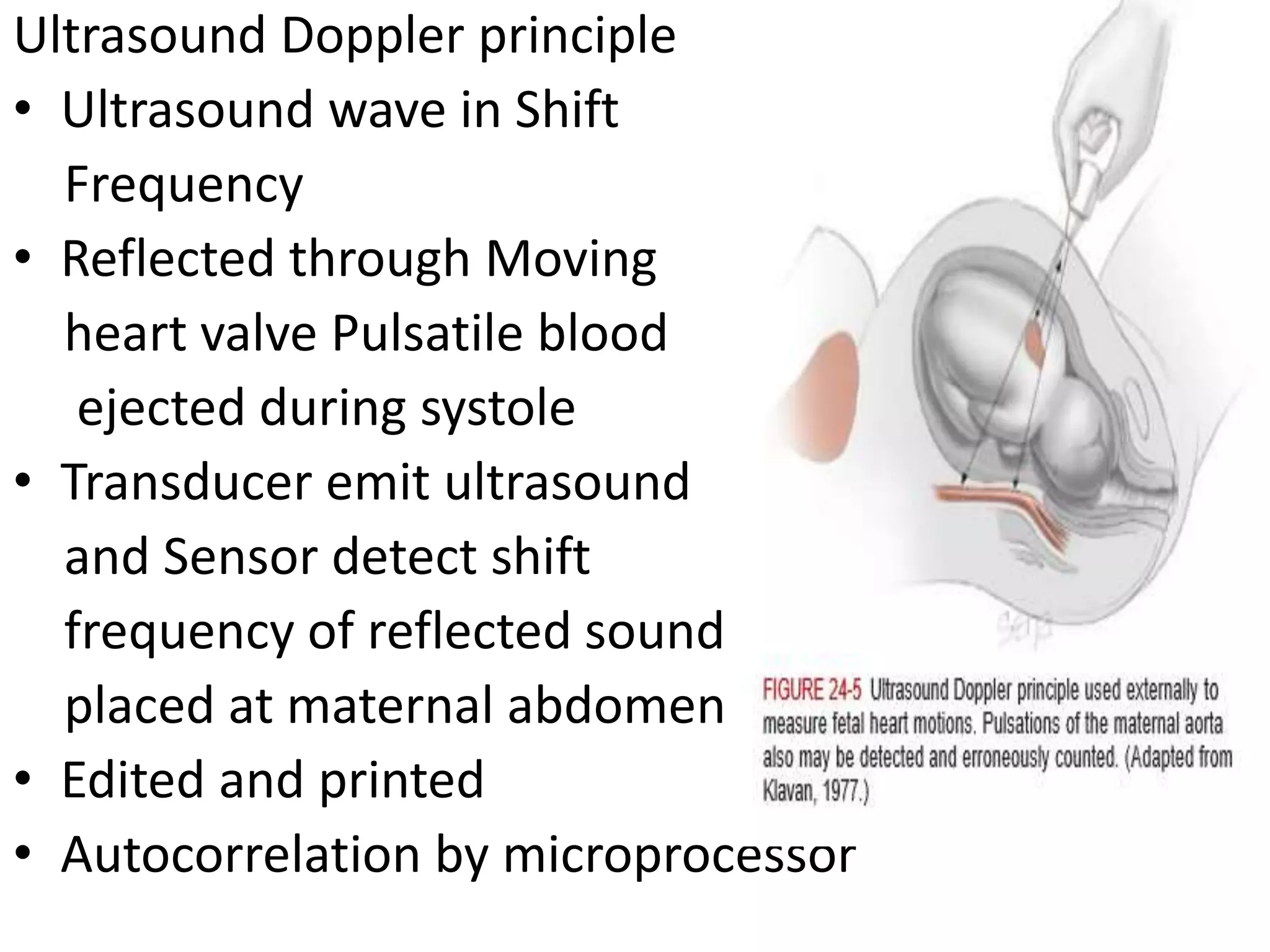 Electronic fetal monitoring | PPTX