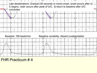 Electronic fetal monitoring. ppt | PPT