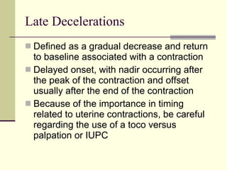 Deceleration Definition