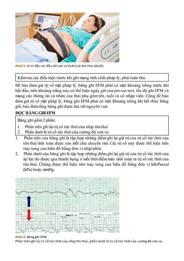 ELECTRONIC FETAL MONITORING ( CTG ) CĂN BẢN TRONG THỰC HÀNH SẢN PHỤ KHOA | PDF