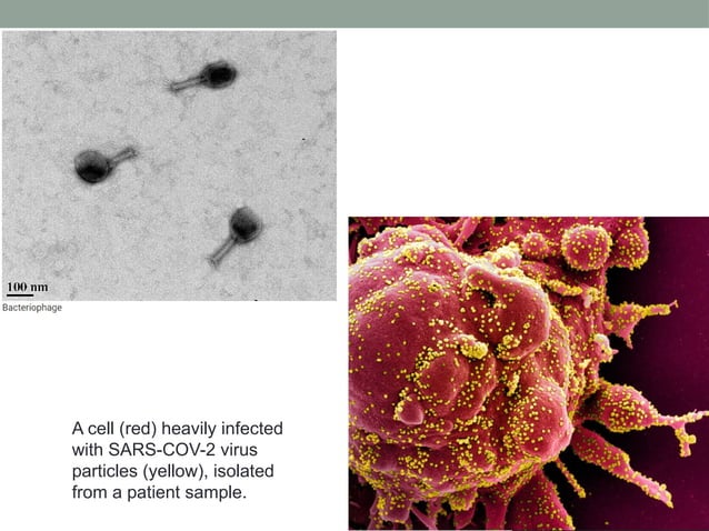 Electron Microscope (principle, operation procedure, types, TEM, SEM ...