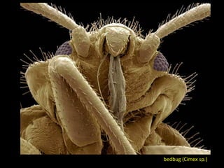 Electron microscope pictures | PPT